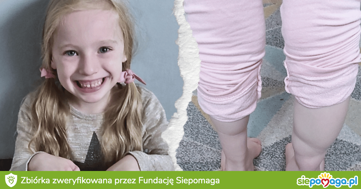 Alicja Bukowska - zbiórka charytatywna | Siepomaga.pl